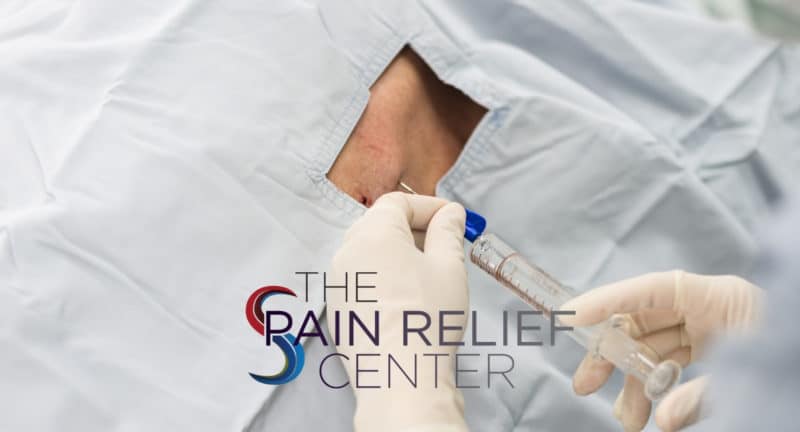 Caudal Epidural Steroid Injection | The Pain Relief Center | Frisco & Plano