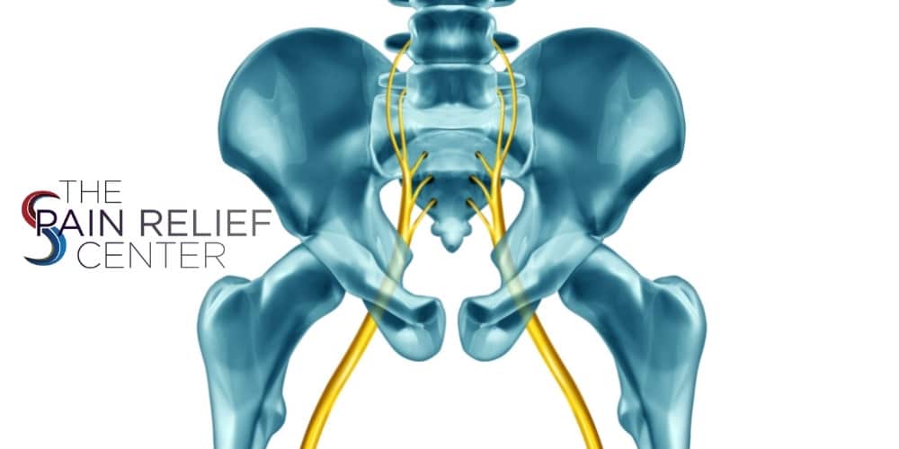 Ganglion Impar Block | The Pain Relief Center | Groin/Pelvic Pain